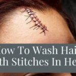 How To Wash Hair With Stitches In Head - Camping Goals