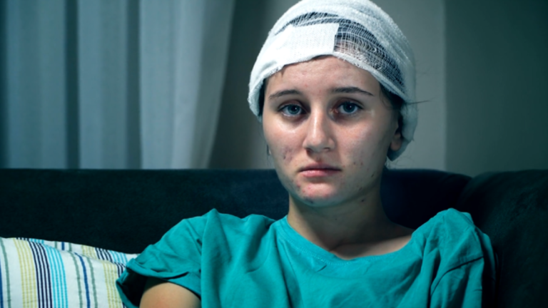 How to Treat Cut on Head Under Hair - 2024 Guide