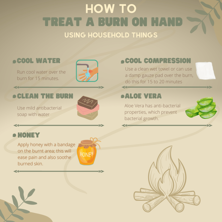 How to Treat a Burn on Hand From Hot Pan - Using Household Things