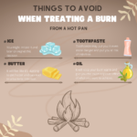 How to Treat a Burn on Hand From Hot Pan - Using Household Things